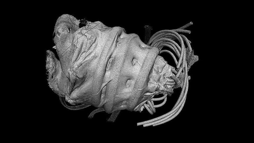 New robot wraps around heart to help organ beat