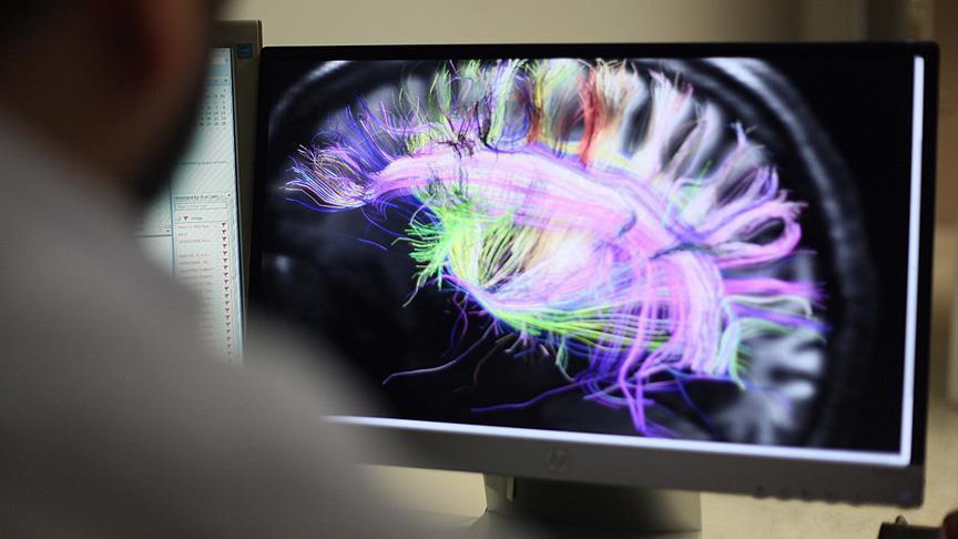 US scientists grow ‘minibrains’ in lab