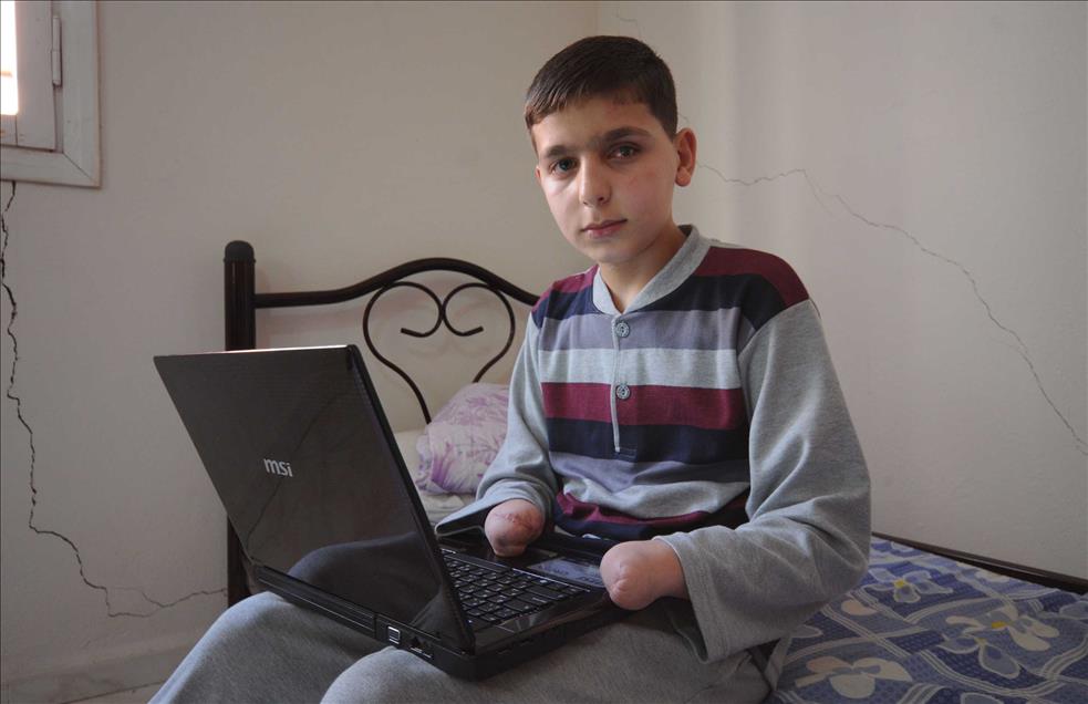 Suriyeli Ali'ye Türkiye ''el'' verdi - Anadolu Ajansı