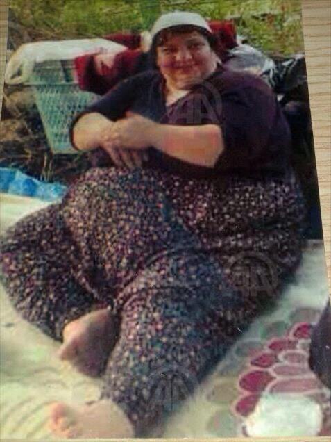 Turkey, a woman lost weight from being 145 kg to 80 kg, now her husband ...